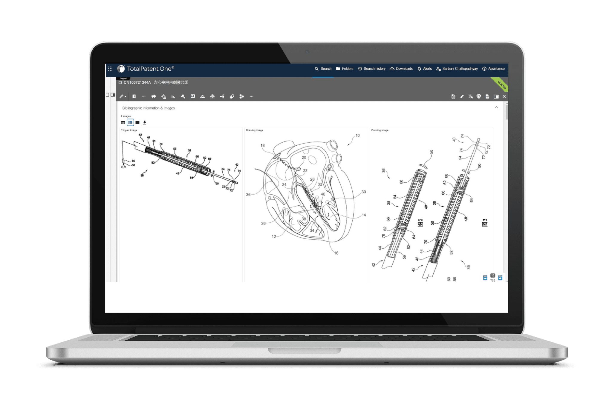 Advanced Patent Search Tools Reinforce IP Teams